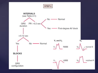 Rapid interpretation of ECG | PPT
