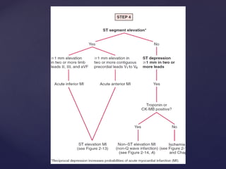 Rapid interpretation of ECG | PPT