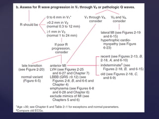 Rapid interpretation of ECG | PPT
