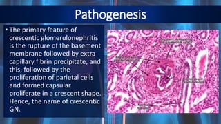 Rapidly progressive glomerulonephritis.pptx
