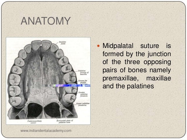 Rapid maxillary expansion in orthodontics