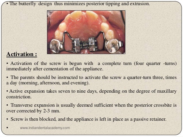 Rapid maxillary expansion in orthodontics