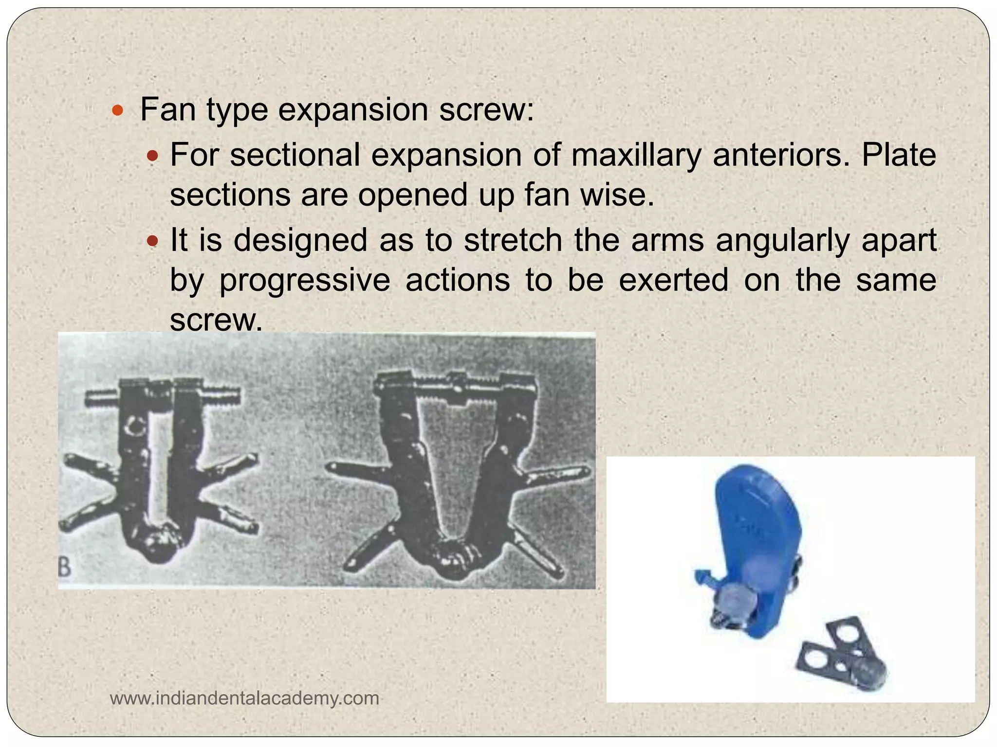 Rapid maxillary expansion in orthodontics / dental crown & bridge ...