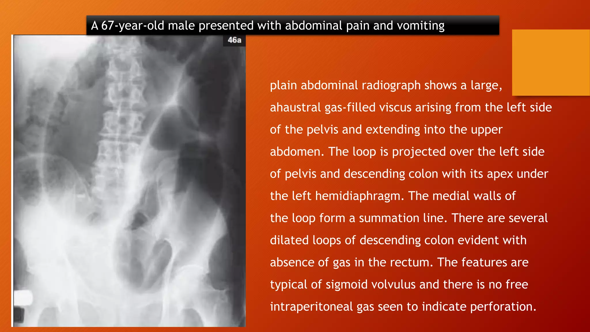 Rapid review of radiology abdomen | PPTX