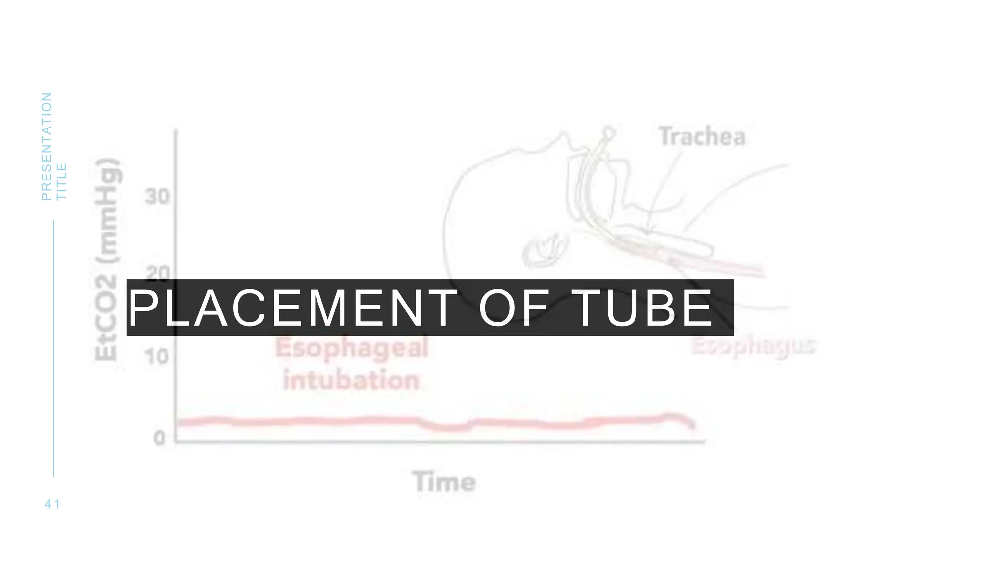 Rapid sequence induction and intubation.pptx