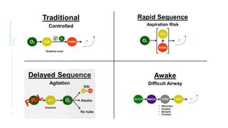 Rapid sequence induction and intubation.pptx