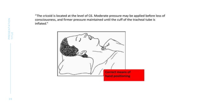 Rapid sequence induction and intubation.pptx | First Aid | Injuries