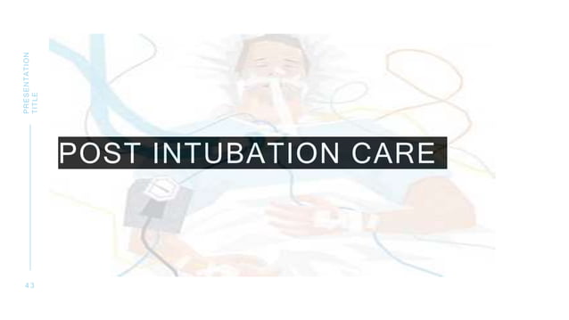 Rapid sequence induction and intubation.pptx | First Aid | Injuries