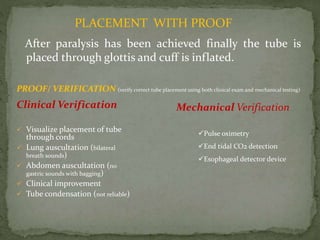 Rapid sequence intubation | PPTX