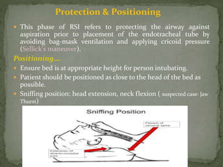 Rapid sequence intubation | PPTX