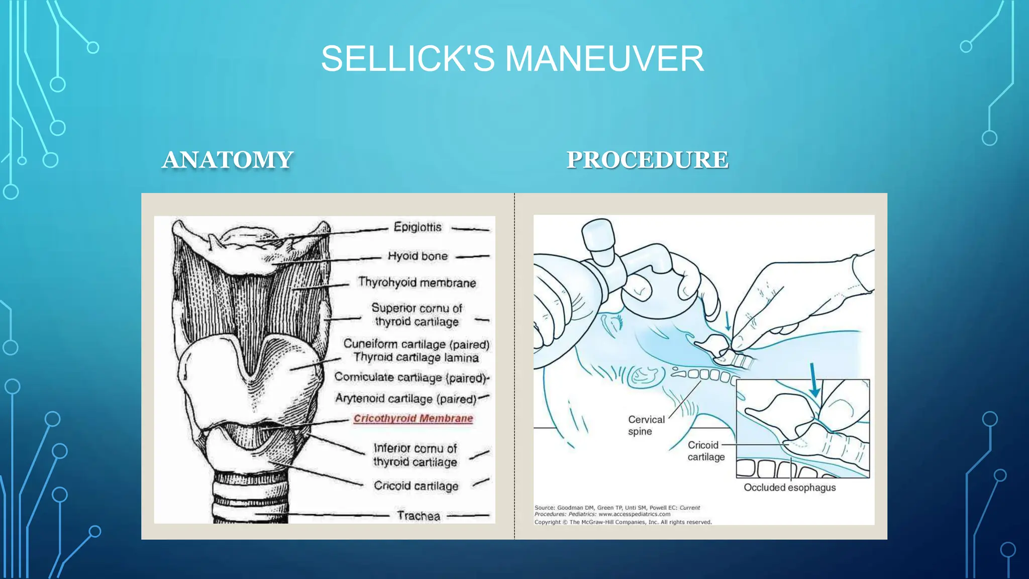 Rapid Sequence Intubation.pptx