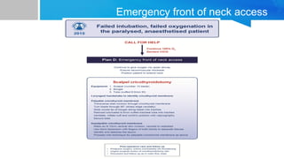 Rapid Sequence Intubation.pptxghhhghgggh | PPTX