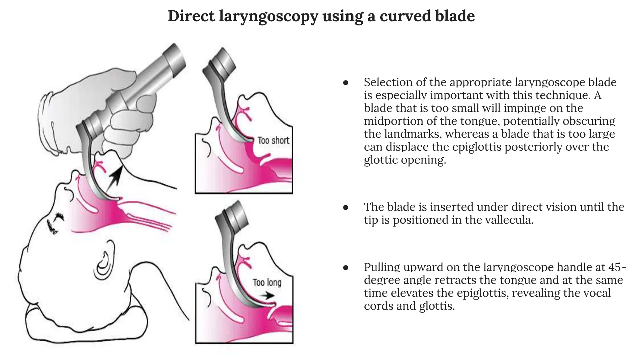 Rapid Sequence Intubation (RSI).pptx
