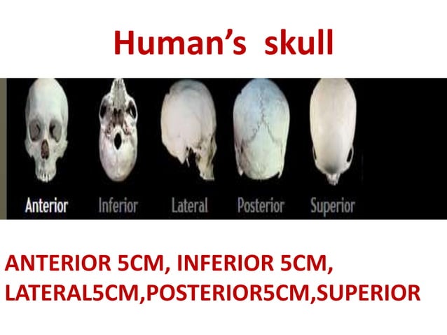 Comparison of Human and Chimpanzee Skeletons | PPTX