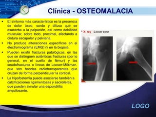 Raquitismo y osteomalacia | PPTX