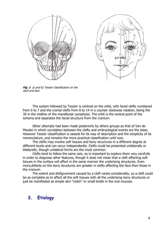 Fissuras de Tessier | PDF