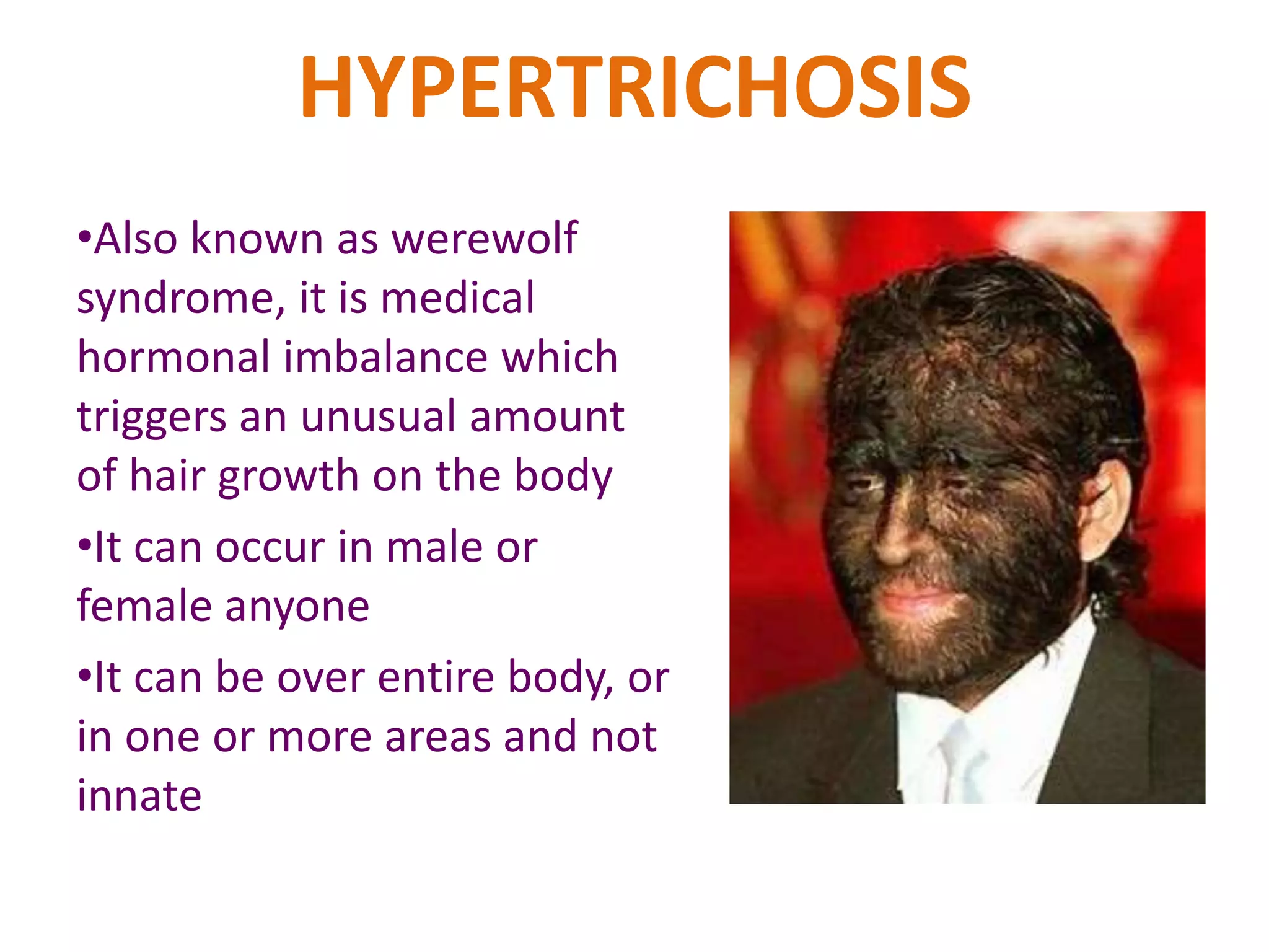 Rare disease in human | PPTX