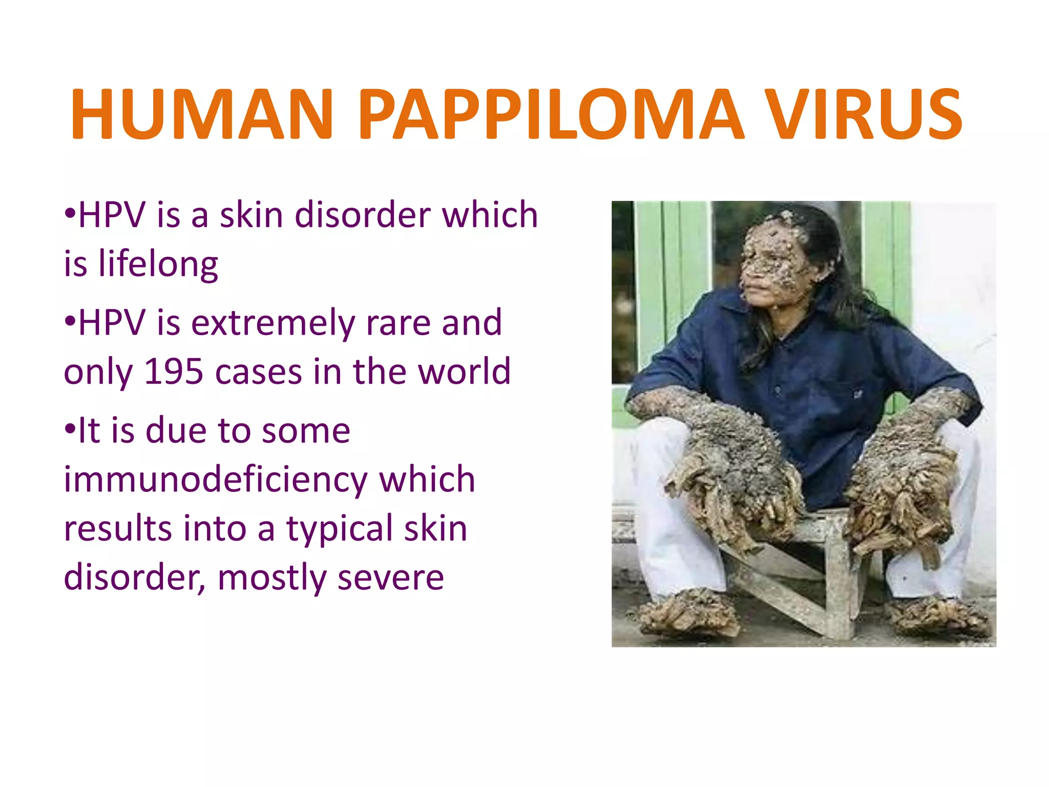 Rare disease in human | PPTX