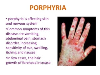 Rare disease in human | PPTX