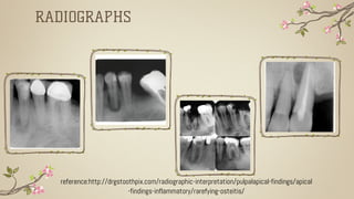 Rarefying ostistis ppt | PDF