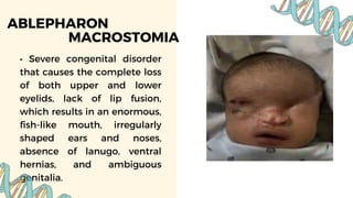 RARE GENETIC DISORDERS ( PSYDEV)_20231016_205058_0000.pptx