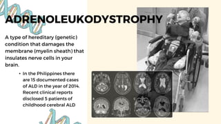RARE GENETIC DISORDERS ( PSYDEV)_20231016_205058_0000.pptx
