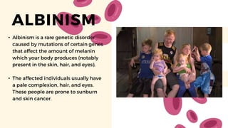 RARE GENETIC DISORDERS ( PSYDEV)_20231016_205058_0000.pptx