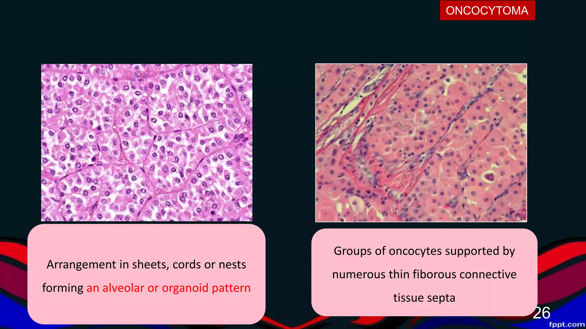 Rare salivary gland lesions.ppt