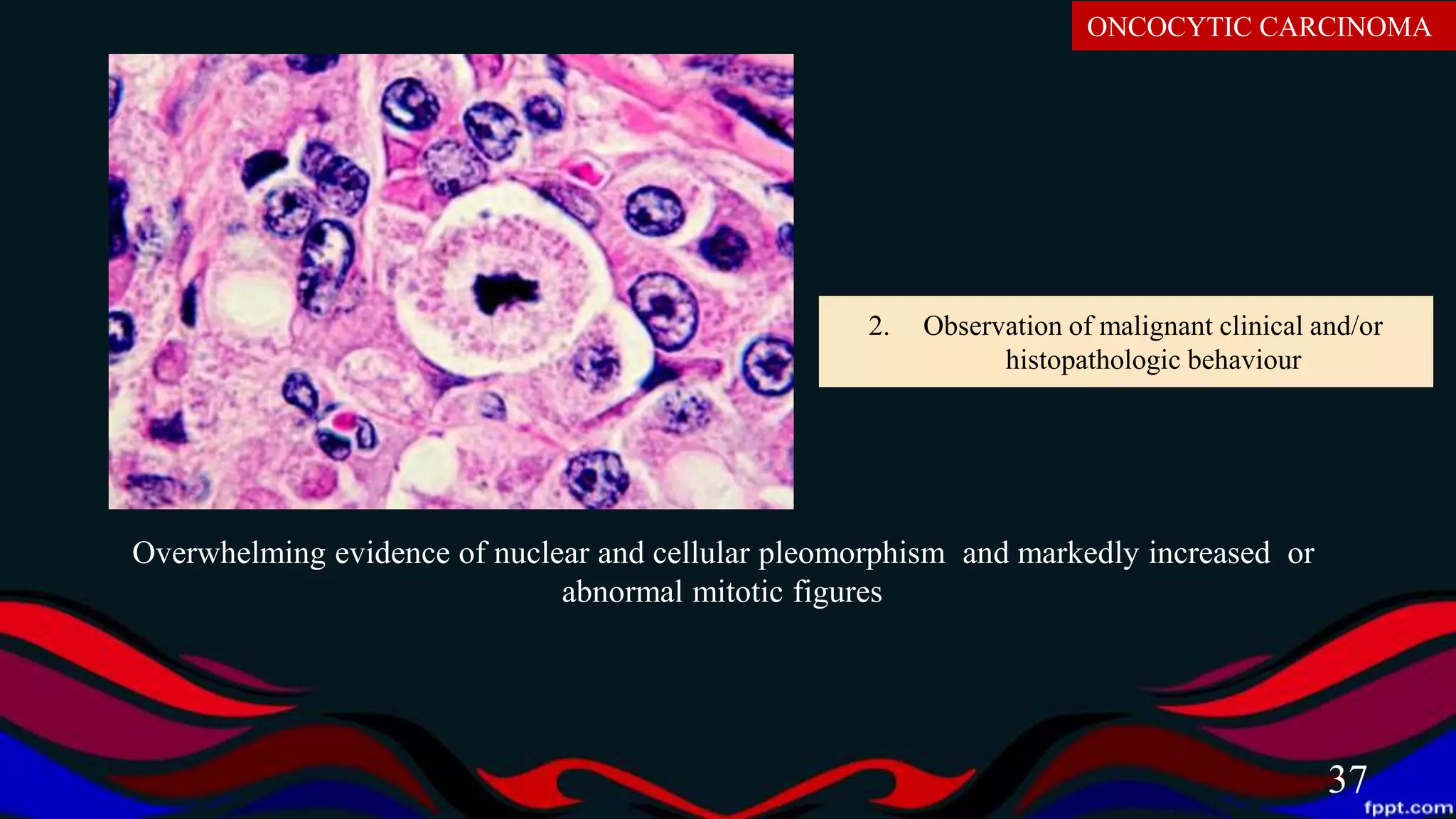 Rare salivary gland lesions.ppt