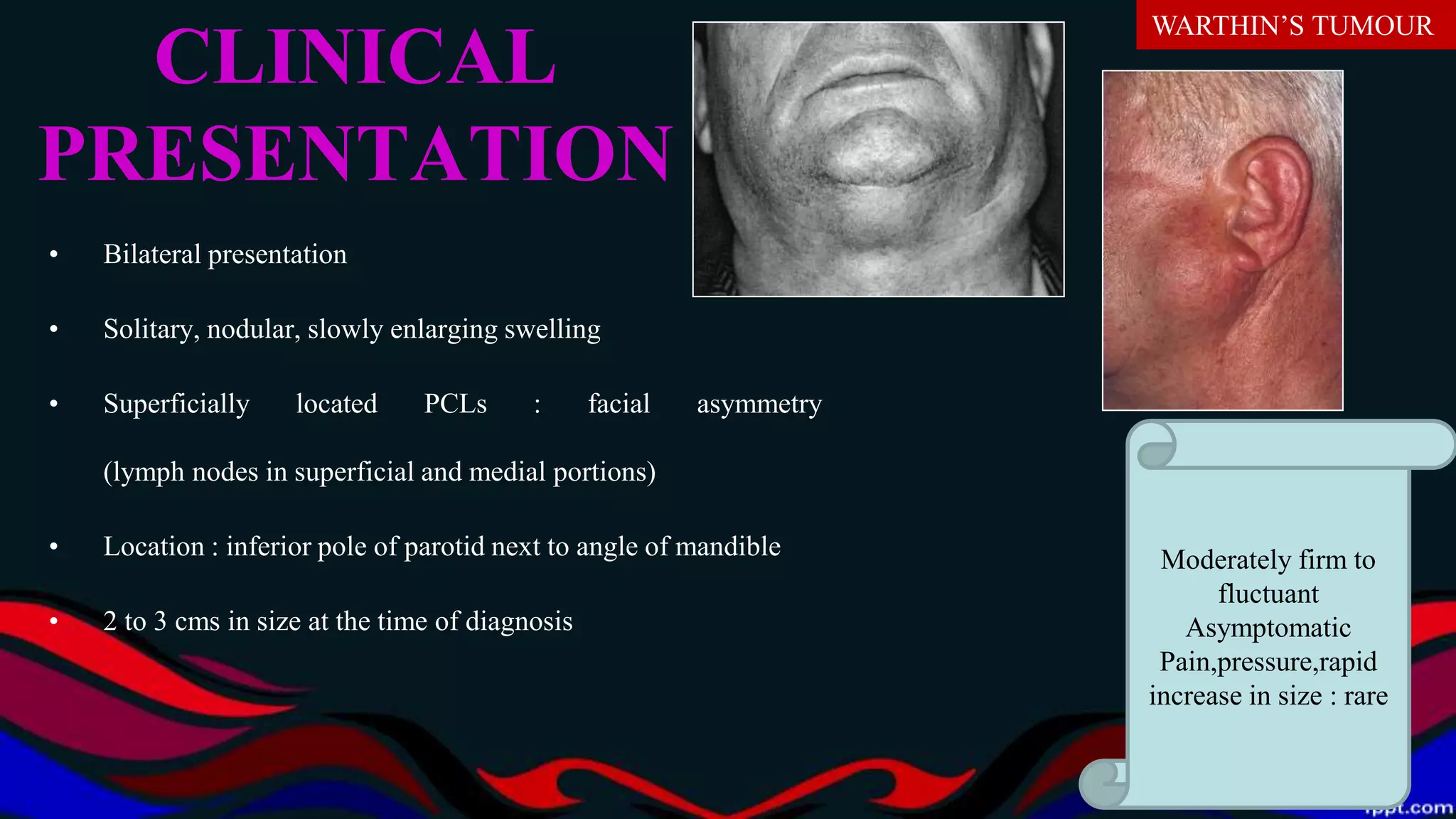 Rare salivary gland lesions.ppt