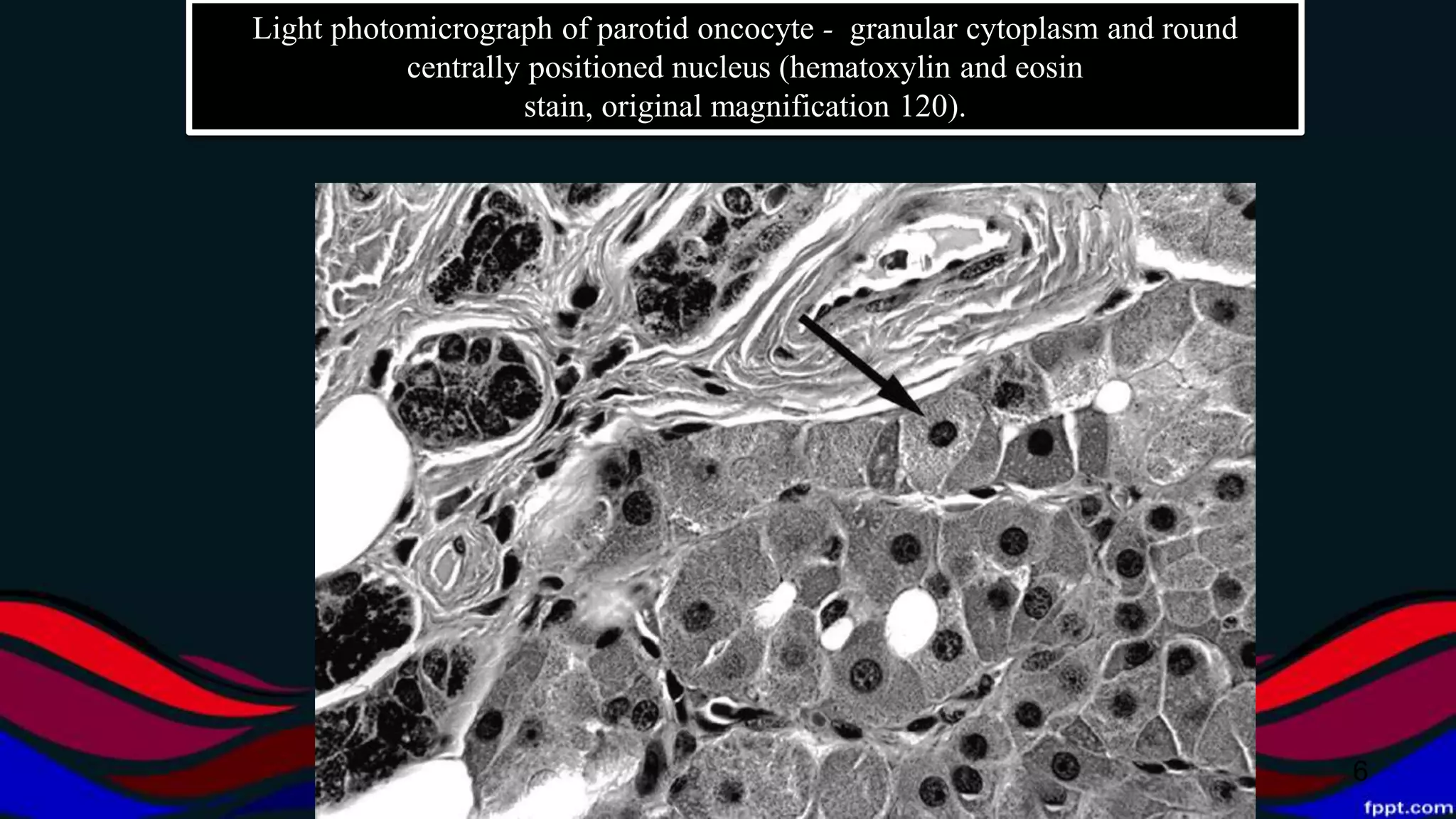 Rare salivary gland lesions.ppt