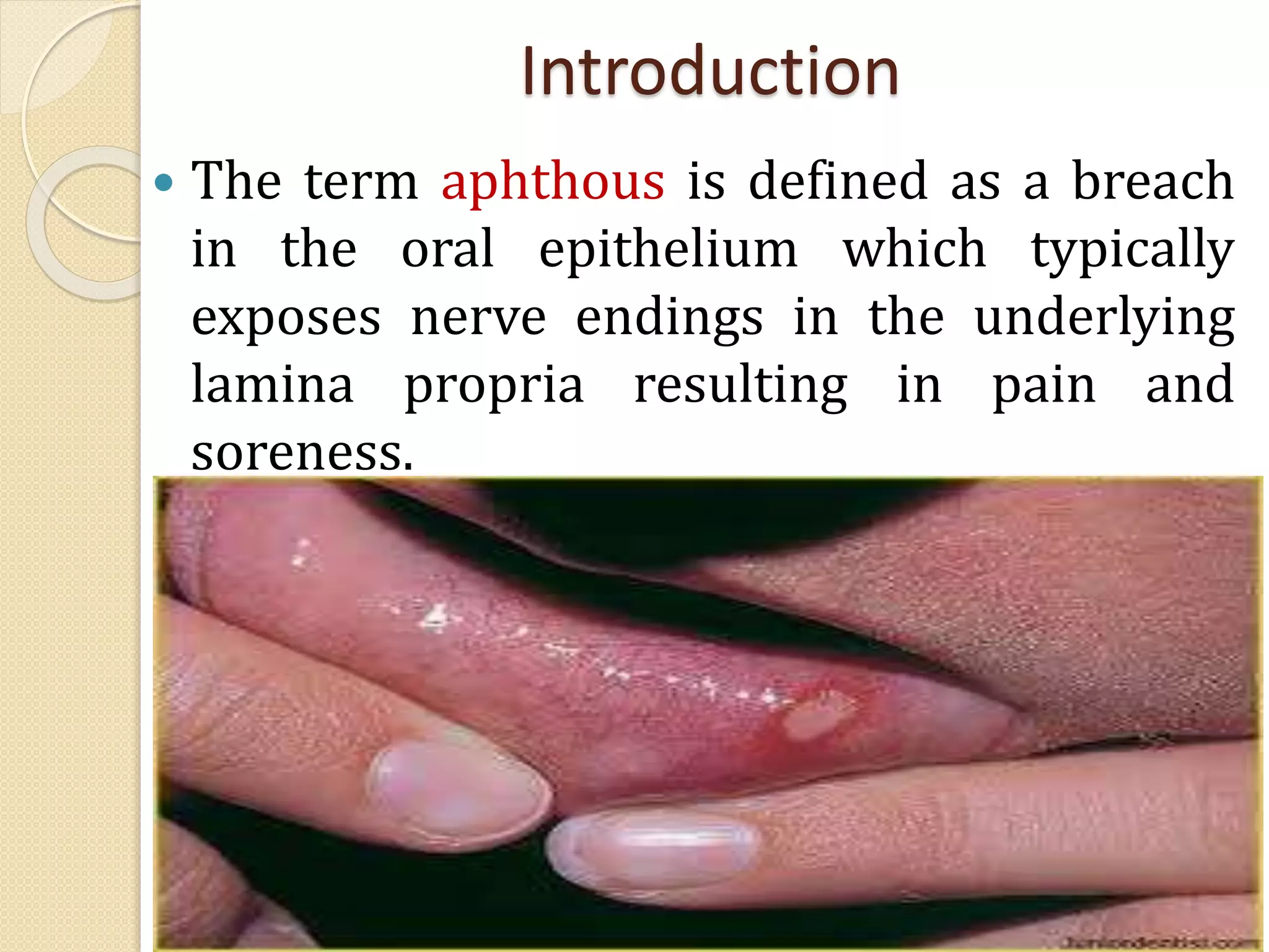 Recurrent Aphthous Stomatitis | PPTX