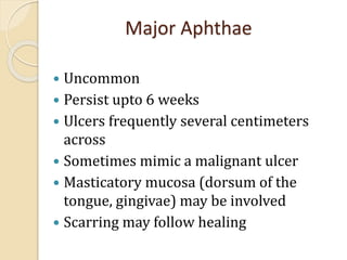 Recurrent Aphthous Stomatitis | PPTX