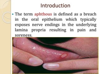 Recurrent Aphthous Stomatitis | PPTX