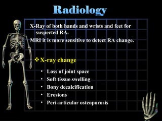 Rheumatoid arthritis diagnosis | PPT