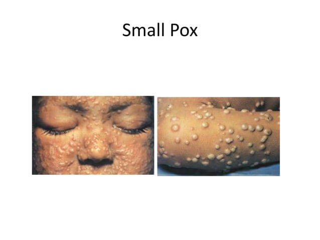 Approach to Common Pediatric Rashes .pptx | Infectious Diseases ...