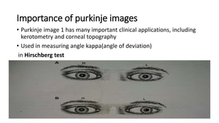 purkinje images | PPT