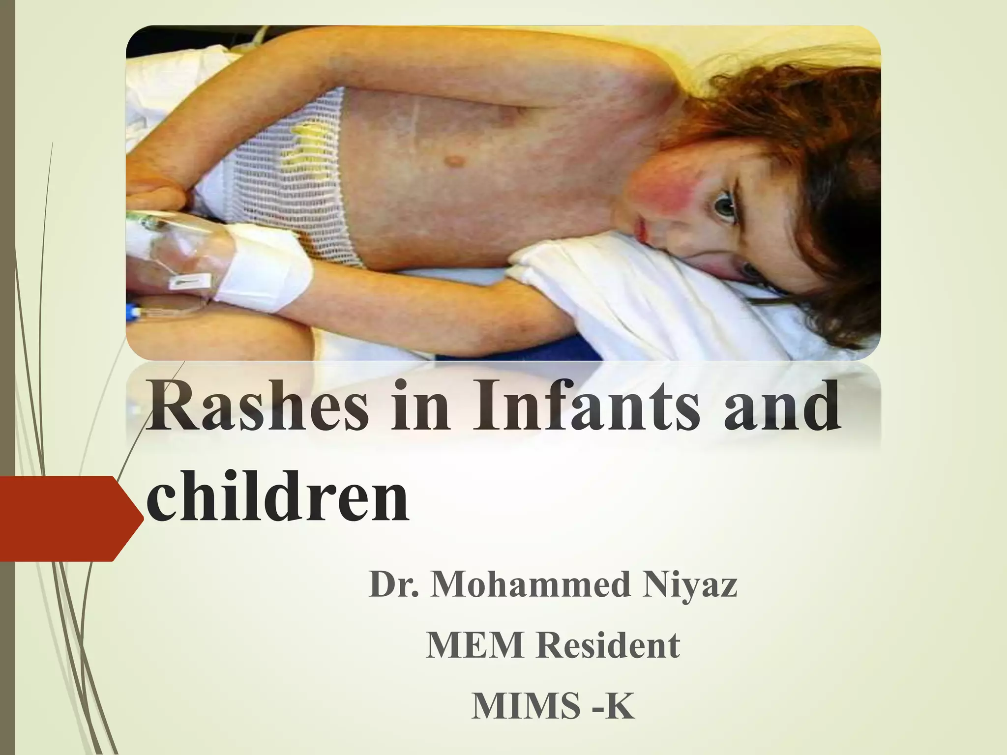 Rashes in infants and children | PPTX