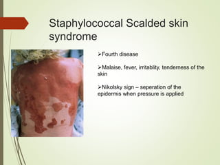 Rashes in infants and children | PPTX
