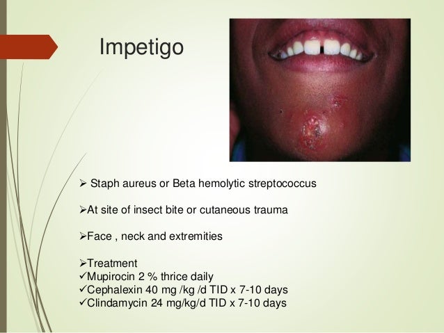 Rashes in infants and children