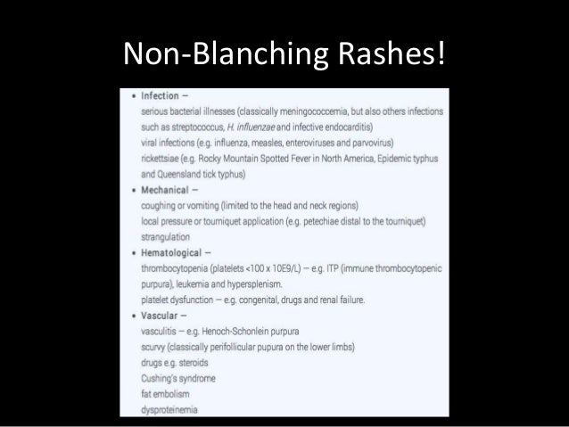 What's Rash is that!