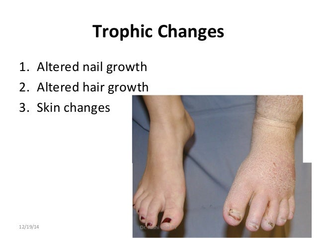 Rashi crps recent advances slideshare