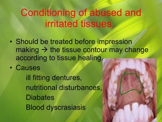 pre prosthetic mouth preparation | PPT