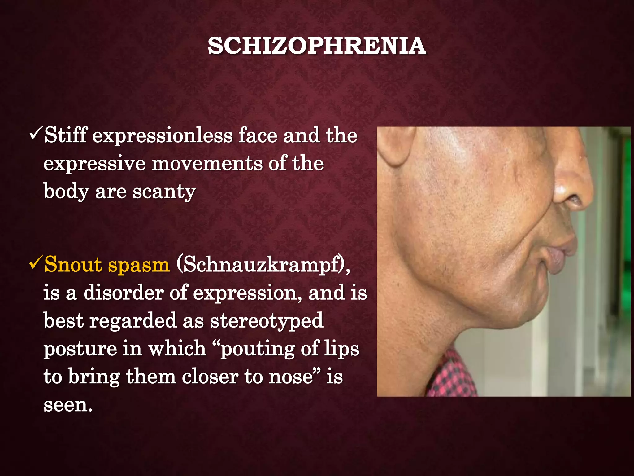 rashmi motor disorder.pptx