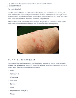 Rash On Skin That Itches - How to Make a Rash Go Away Fast and Easily | PDF