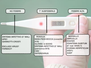 Percorso diagnostico dei rash virali in età pediatrica | PPT