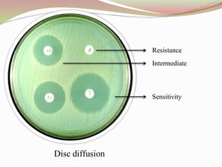 Antimicrobial susceptibility test | PDF