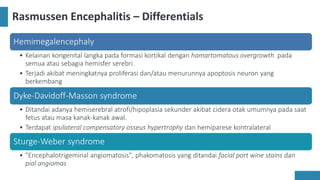 Rasmussen Encephalitis.pptx