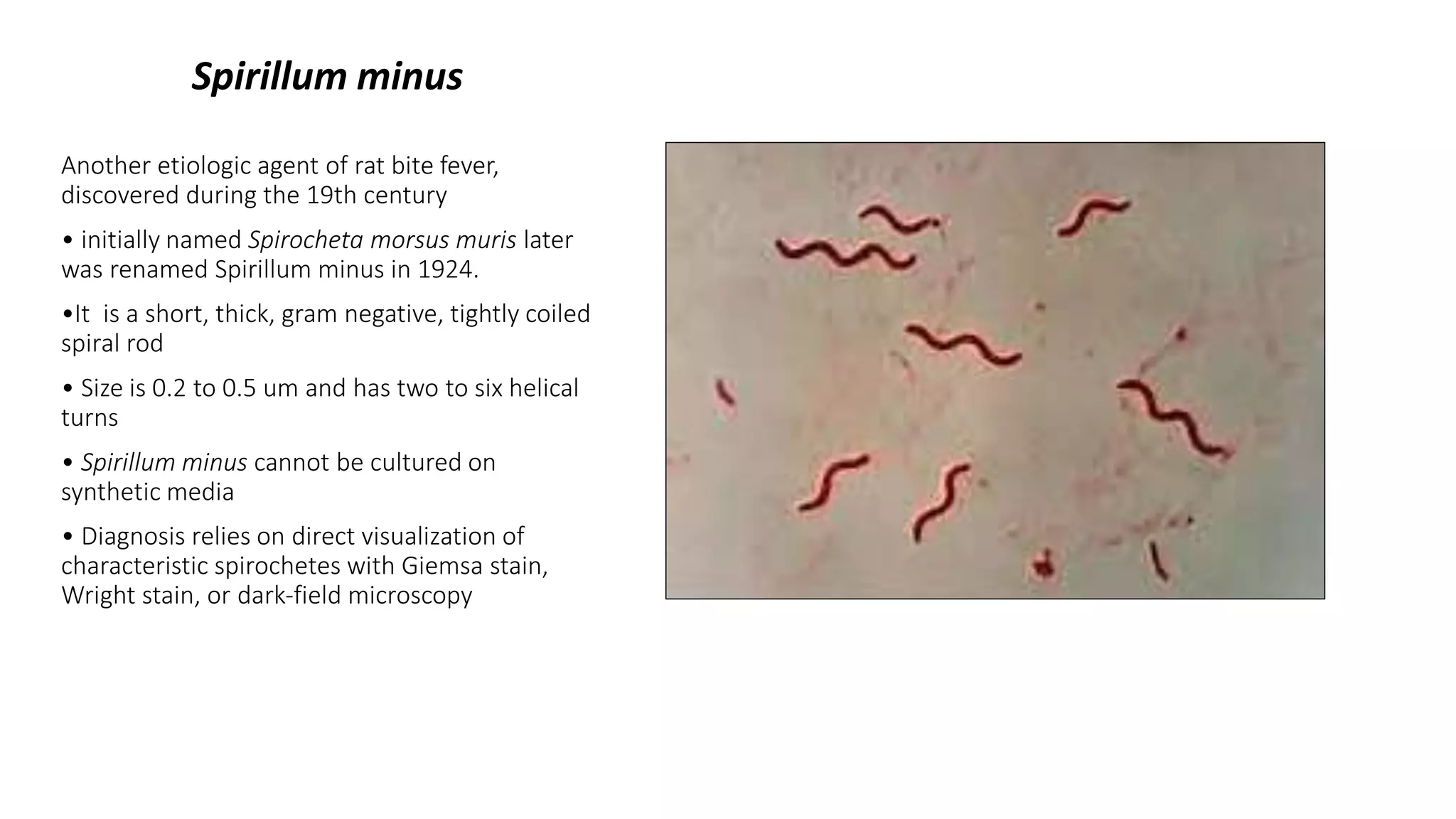 Rat bite fever | PDF