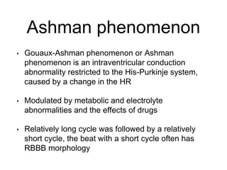 Rate dependent Bundle Branch Block | PPTX